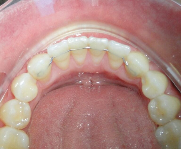 Conten o Ortod ntica Renauld Moreira Odontologia Conten o Ortod ntica Renauld Moreira Odontologia